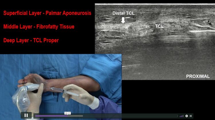 Procedure Videos & Resources - Sonex Health